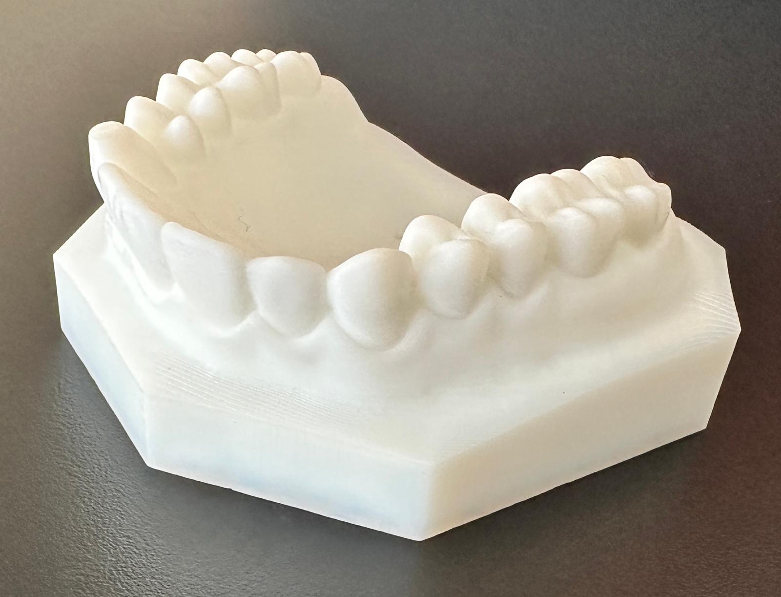 Study models – Digital Orthodontic Dental Lab located in Melbourne